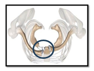 Case report of bilateral sternoclavicular dislocation associated with ...