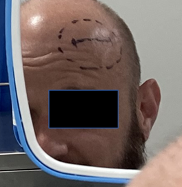 Experiences in growing a skin radiation therapy practice - MedCrave online