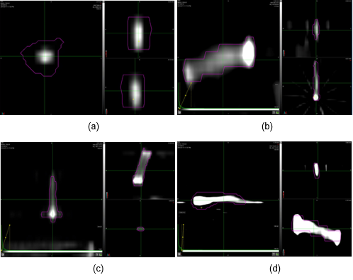 Physical characteristics in cone beam computed Tomography (CBCT ...