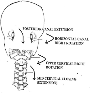 Dependent head posture dizziness syndrome: a case report - MedCrave online