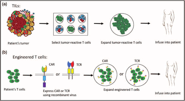 Tumor-infiltrating lymphocyte therapy: an overview - MedCrave online
