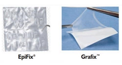 Diabetic foot ulcers: physiology, disease, market analysis, treatments ...