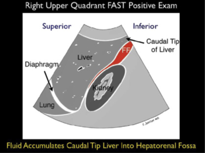 Update on the management of the polytraumatized patient: the role of ...