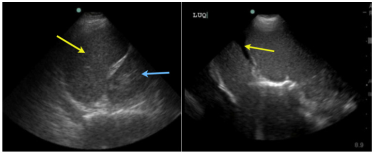 Update on the management of the polytraumatized patient: the role of ...