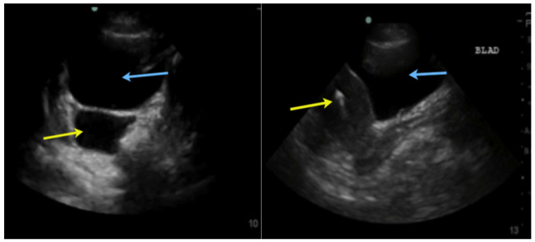 Update on the management of the polytraumatized patient: the role of ...