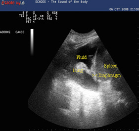 Update on the management of the polytraumatized patient: the role of ...