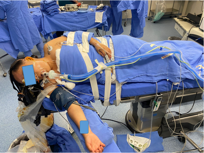 Awake brain surgery in epilepsy: a case report and review of the ...