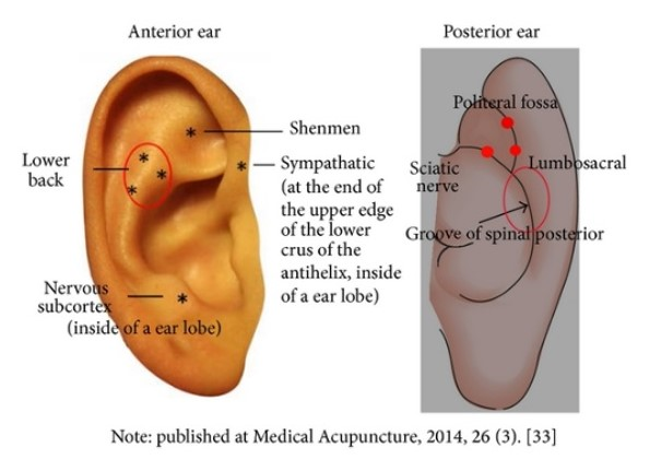 Battlefield Acupuncture (BFA): theoretical use in pre and post ...