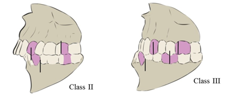 Men lips enhancement: new customized approach for male’s lip treatments ...