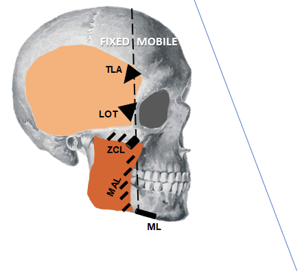 A novel technique for repositioning facial soft tissues with barbed ...