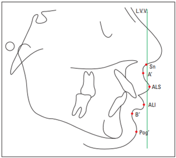 Comparative study between subjective facial analysis and cephalometric ...