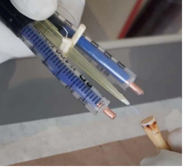 Cold plasma: a good Enterococcus faecalis inhibitor â€“ an in vitro ...