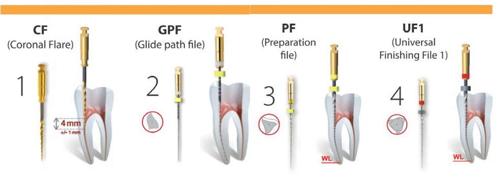 Redefining the new generation endodonticsGenEndo Files: cases reports ...