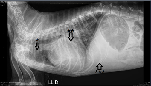 A case report of pulmonary edema associated with left cardiac failure ...