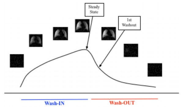 Imaging ventilation using 19F perfluorinated gas magnetic resonance ...