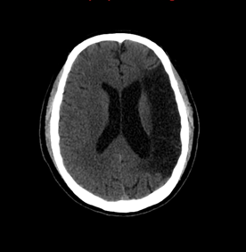 Neuropsychological rehabilitation of Broca's and conduction aphasia ...