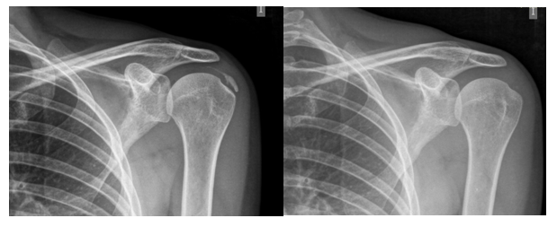 Algorithm of management based on treatment goals for calcifying ...