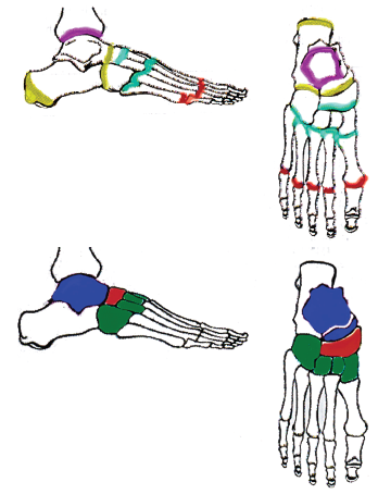 Charcot neuroarthropathy of ankle and foot; Bangladesh experience ...